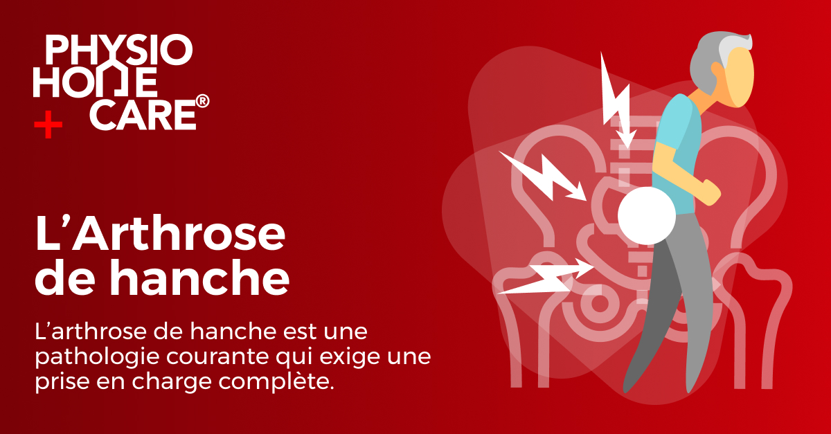 L’arthrose de hanche : prise en charge en physiothérapie - PhysioHomeCare